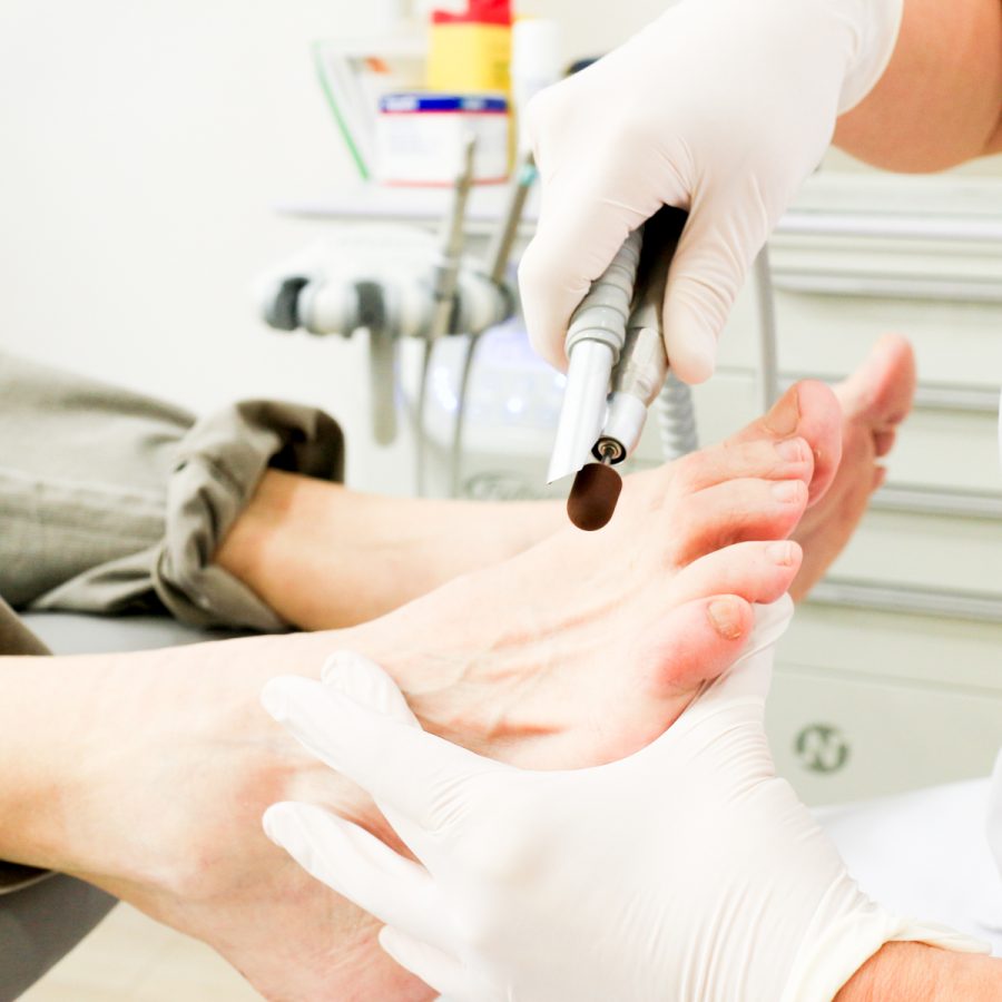 Tratamiento integral del pie - Centro Podológico Goitia