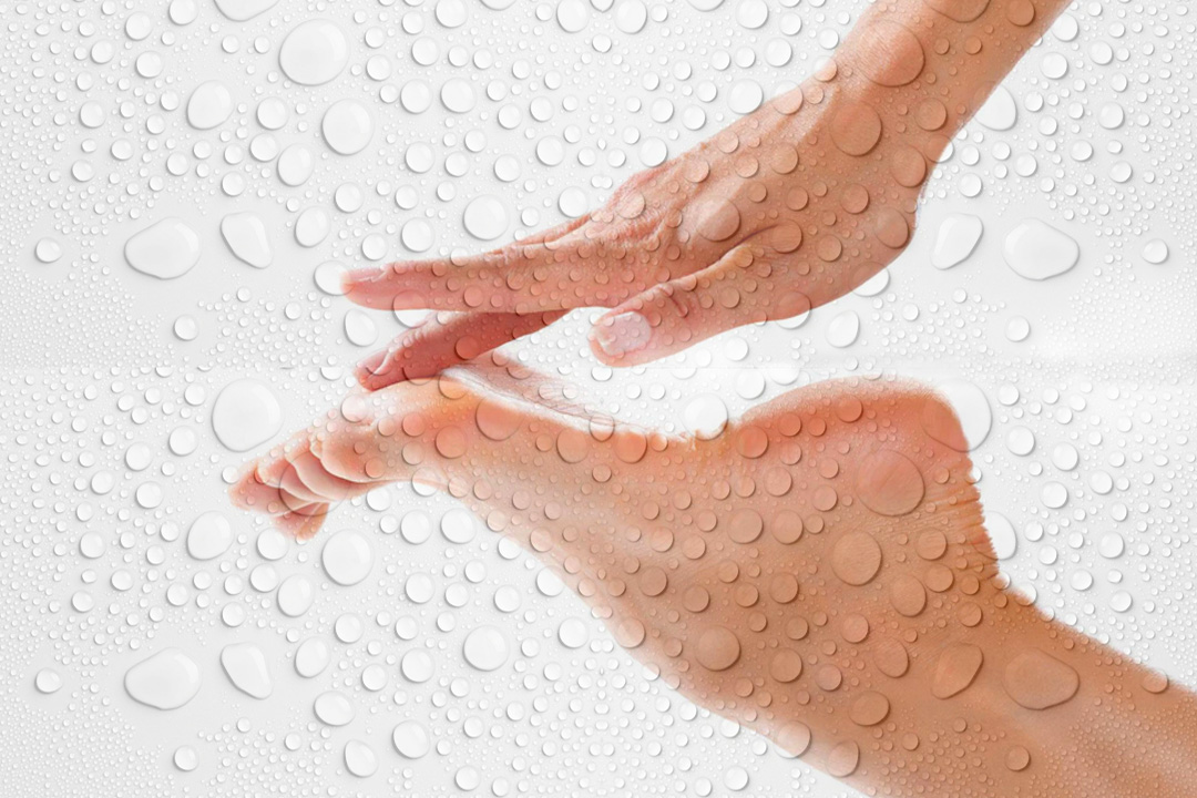 Qué es la hiperhidrosis - Centro Podológico Goitia